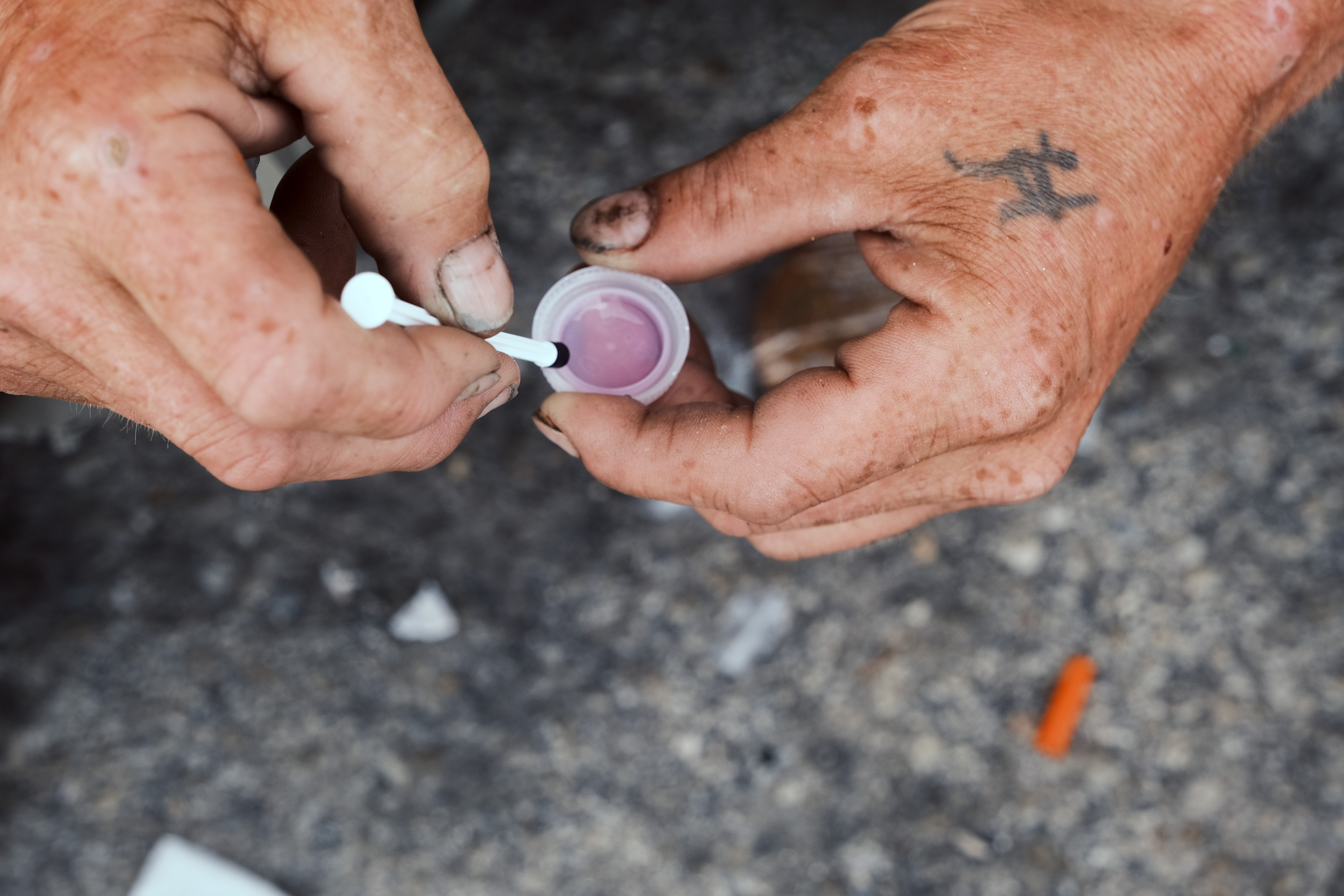 How To Reverse An Overdose From Tranq Dope How To Reverse An Overdose From Tranq Dope