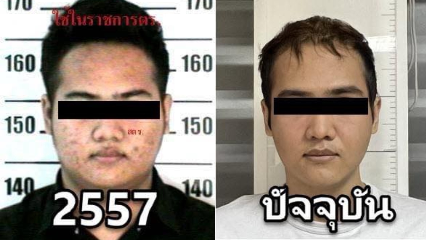 Drug Kingpin Who Underwent ‘face Off Plastic Surgery While Evading